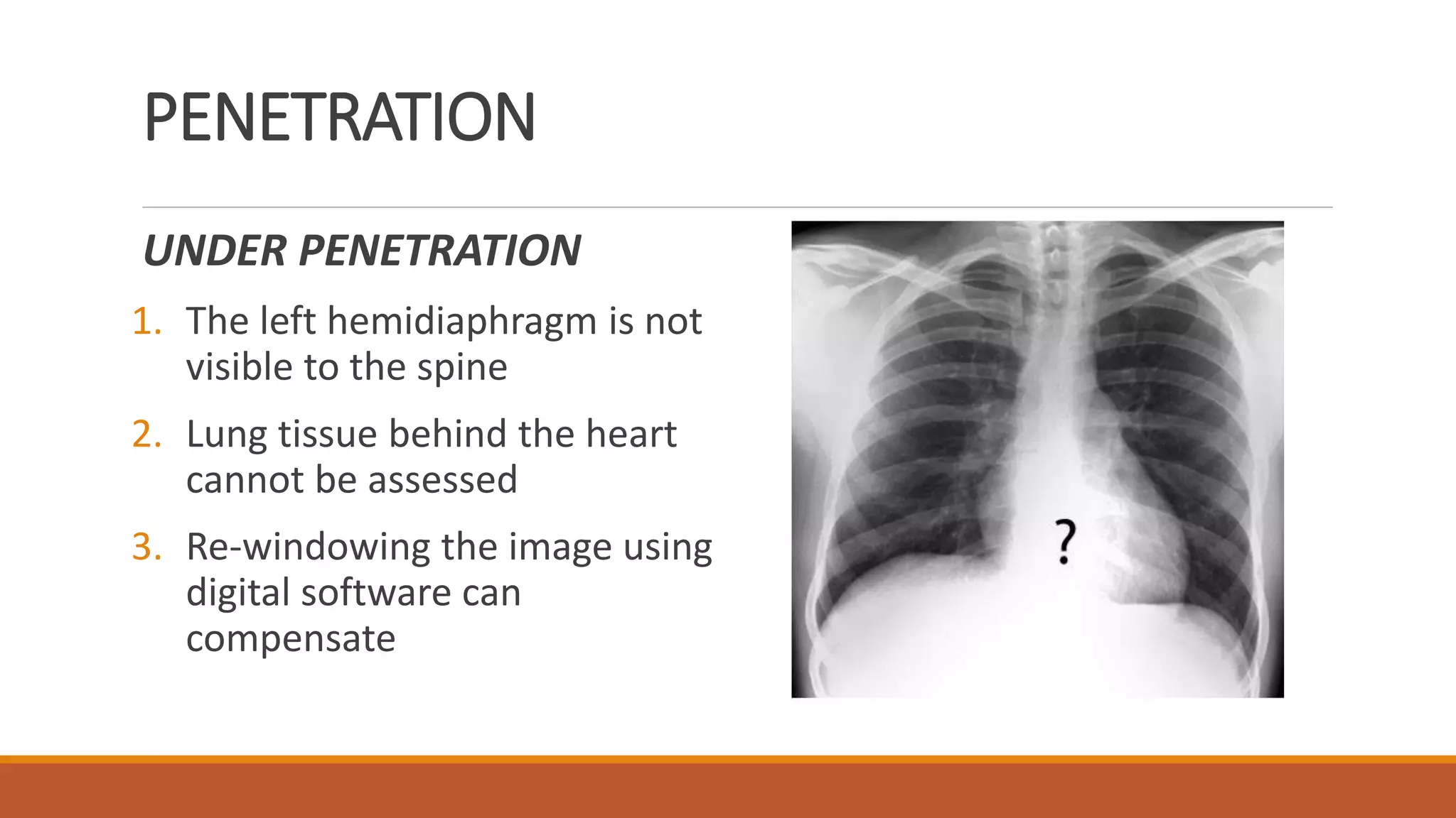 Image interpretation (for radiology residents) | PDF