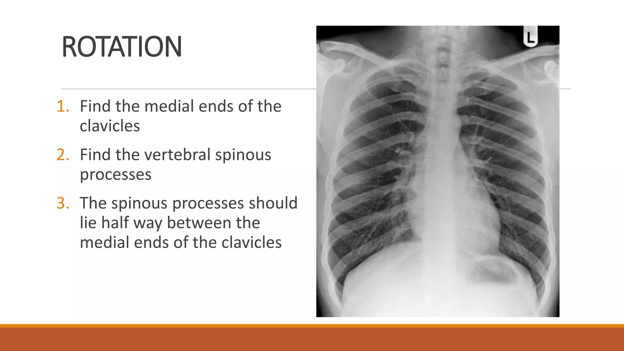 Image interpretation (for radiology residents) | PDF