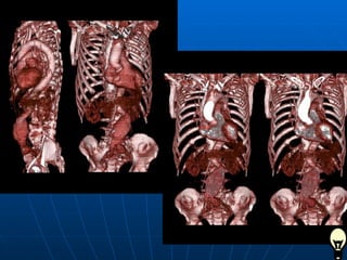 Imagen digital | PPT