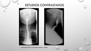 DIAGNOSTICO POR IMÁGENES DE CABEZA Y CUELLO | PPT