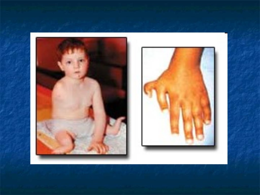 Imagenes de mutaciones (chernobyl)