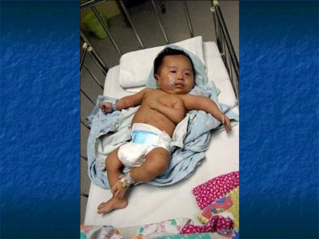 Imagenes de mutaciones (chernobyl)