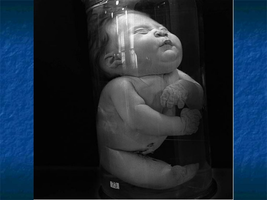 Imagenes de mutaciones (chernobyl)