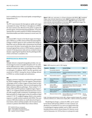Imagenes en lupus | PDF | Brain and Nervous System Disorders | Diseases ...
