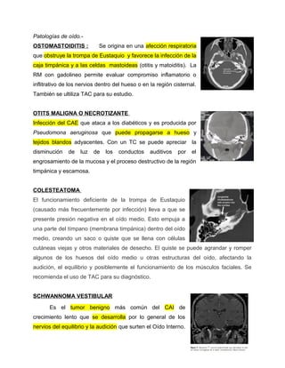 Imagenes patológicas de otras regiones | PDF