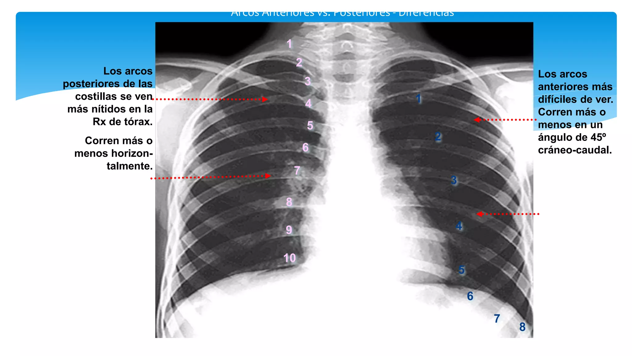 Imagenes radiografia torax | PPT