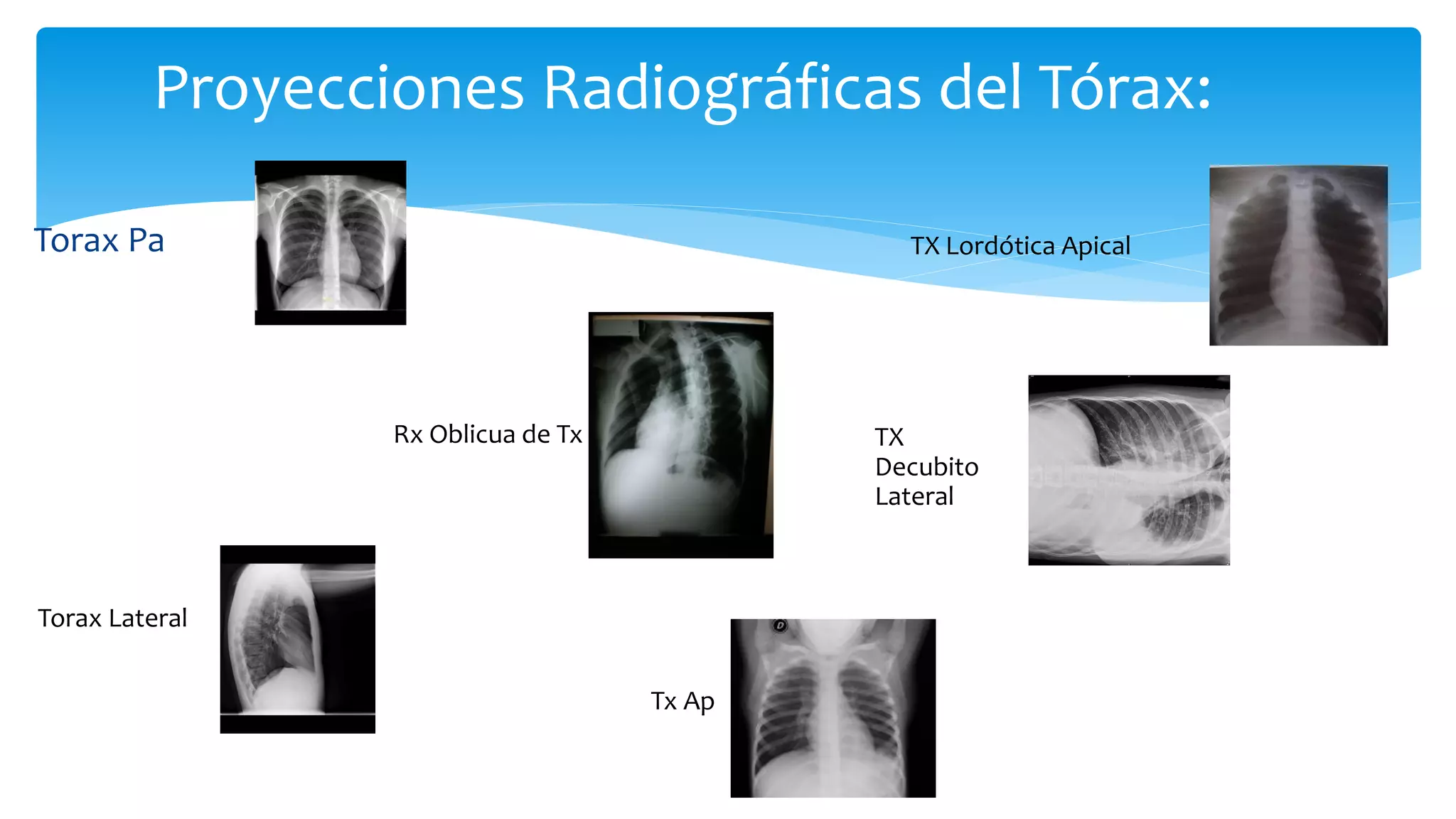 Imagenes radiografia torax | PPT