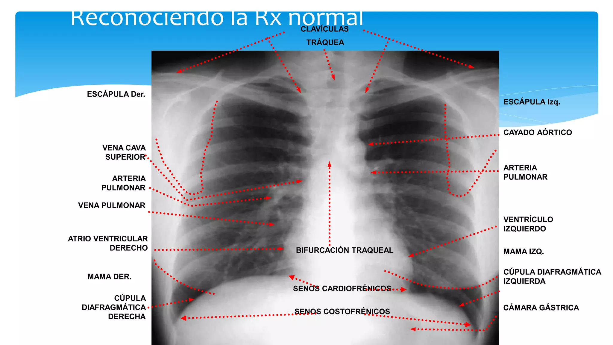 Imagenes radiografia torax | PPT