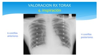 Imagenes radiografia torax | PDF