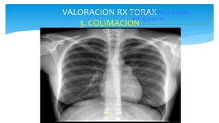 Imagenes radiografia torax | PPTX