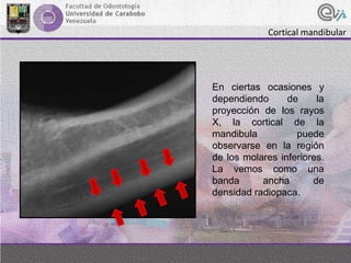 Imagenes radiograficas mandibula | PPTX