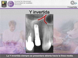Imagenes radiograficas maxilar | PPTX