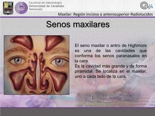 Imagenes radiograficas maxilar | PPTX