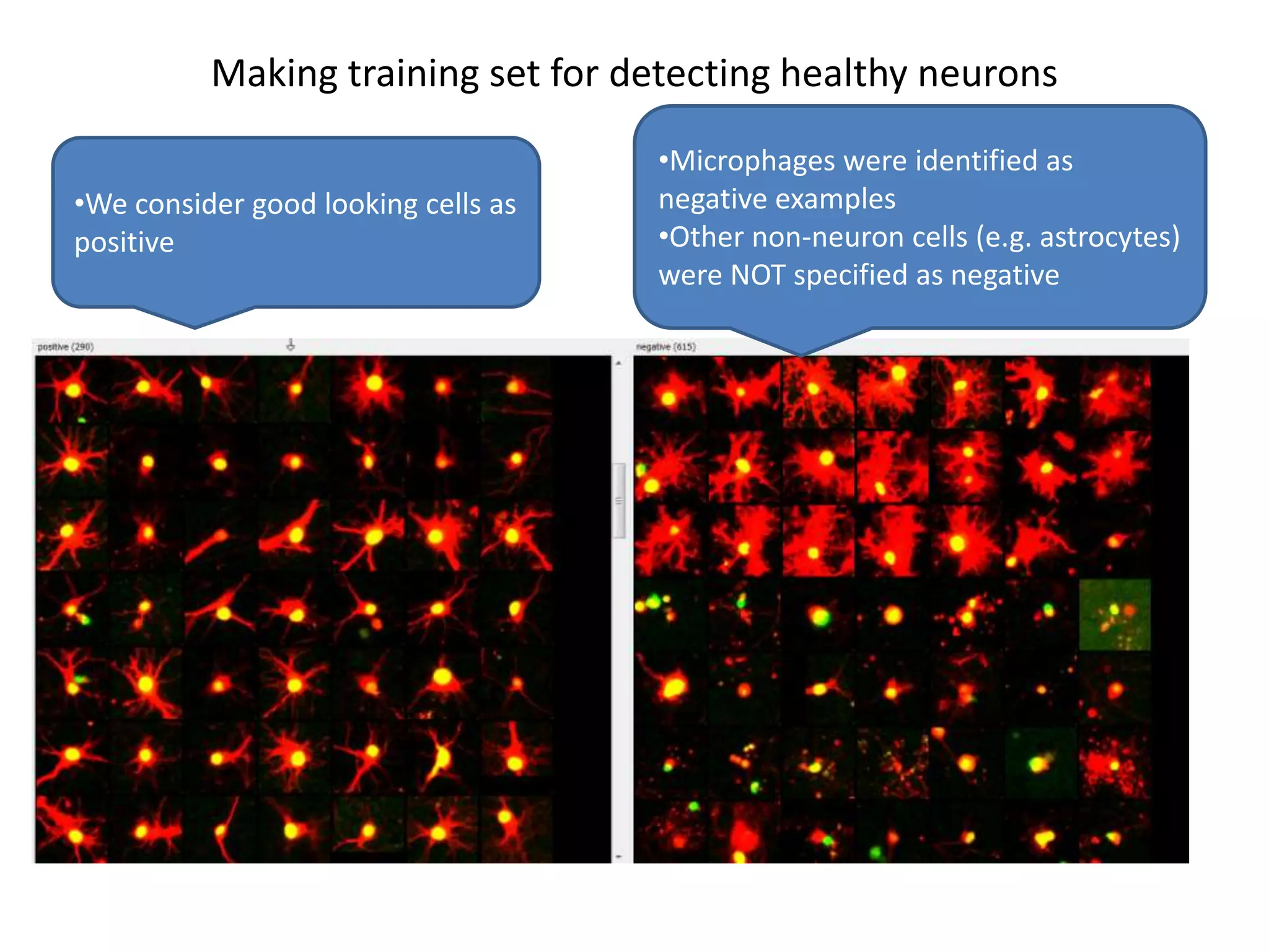 Neuron Detection And Counting In High Throughput Screening Images Ppt