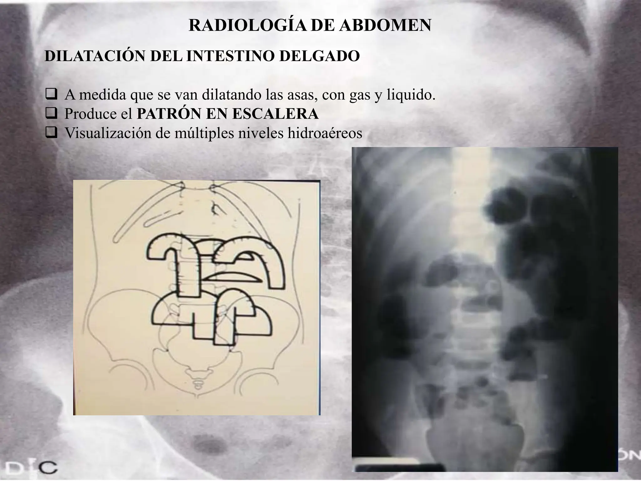 IMAGEN III-ABDOMEN- RADIOLOGIA Y ECOGRAFIA.pptx