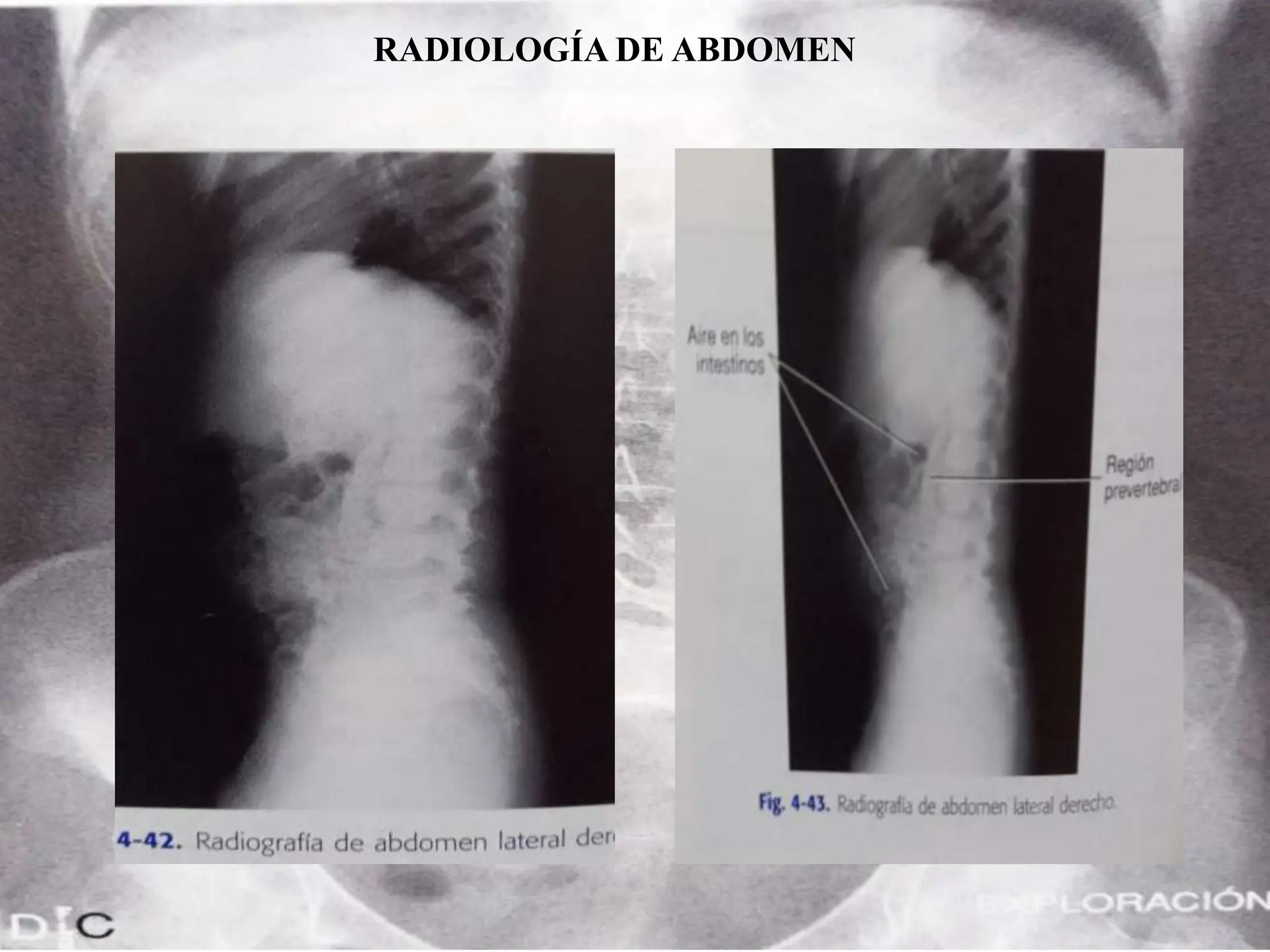 IMAGEN III-ABDOMEN- RADIOLOGIA Y ECOGRAFIA.pptx