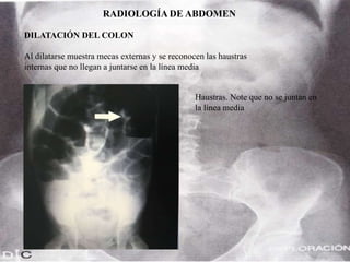 IMAGEN III-ABDOMEN- RADIOLOGIA Y ECOGRAFIA.pptx
