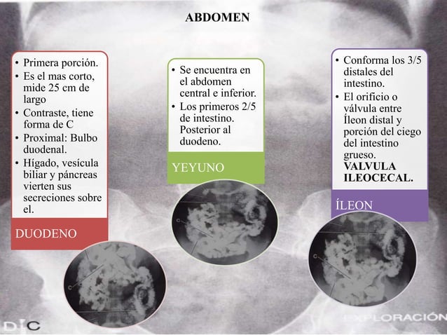 IMAGEN III-ABDOMEN- RADIOLOGIA Y ECOGRAFIA.pptx