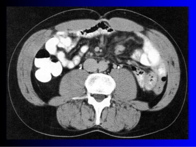 Imagenologia del Abdomen