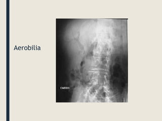 IMAGENOLOGÍA ABDOMEN.IMAGENOLOGÍA ABDOMEN.IMAGENOLOGÍA ABDOMEN. | PPTX
