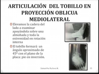 Imagenología de la extremidad inferior anatomía | PPTX