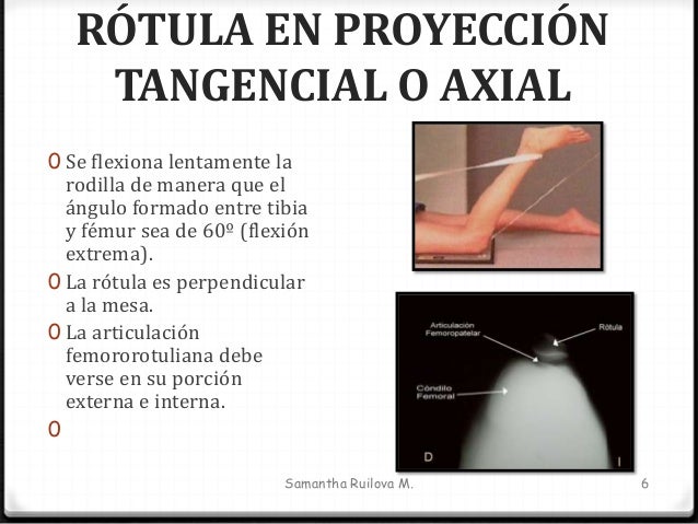 Imagenología de la extremidad inferior anatomía