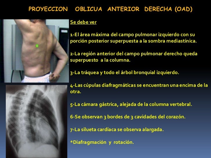 Imagenología del tórax clase