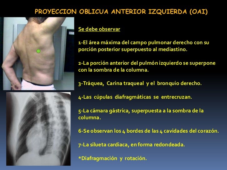 Imagenología del tórax clase