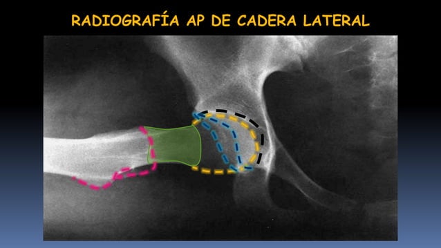 Imagenología de miembro inferior clase | PPTX