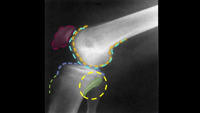 Imagenología de miembro inferior clase | PPTX
