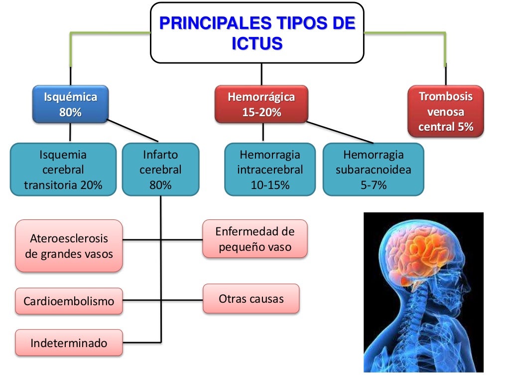 Imagenología integral del ictus isquémico con tc multidetector