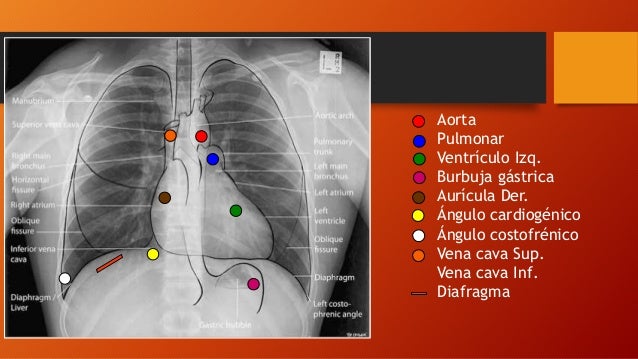 Imagenologia. lectura-de-rx-de-tórax