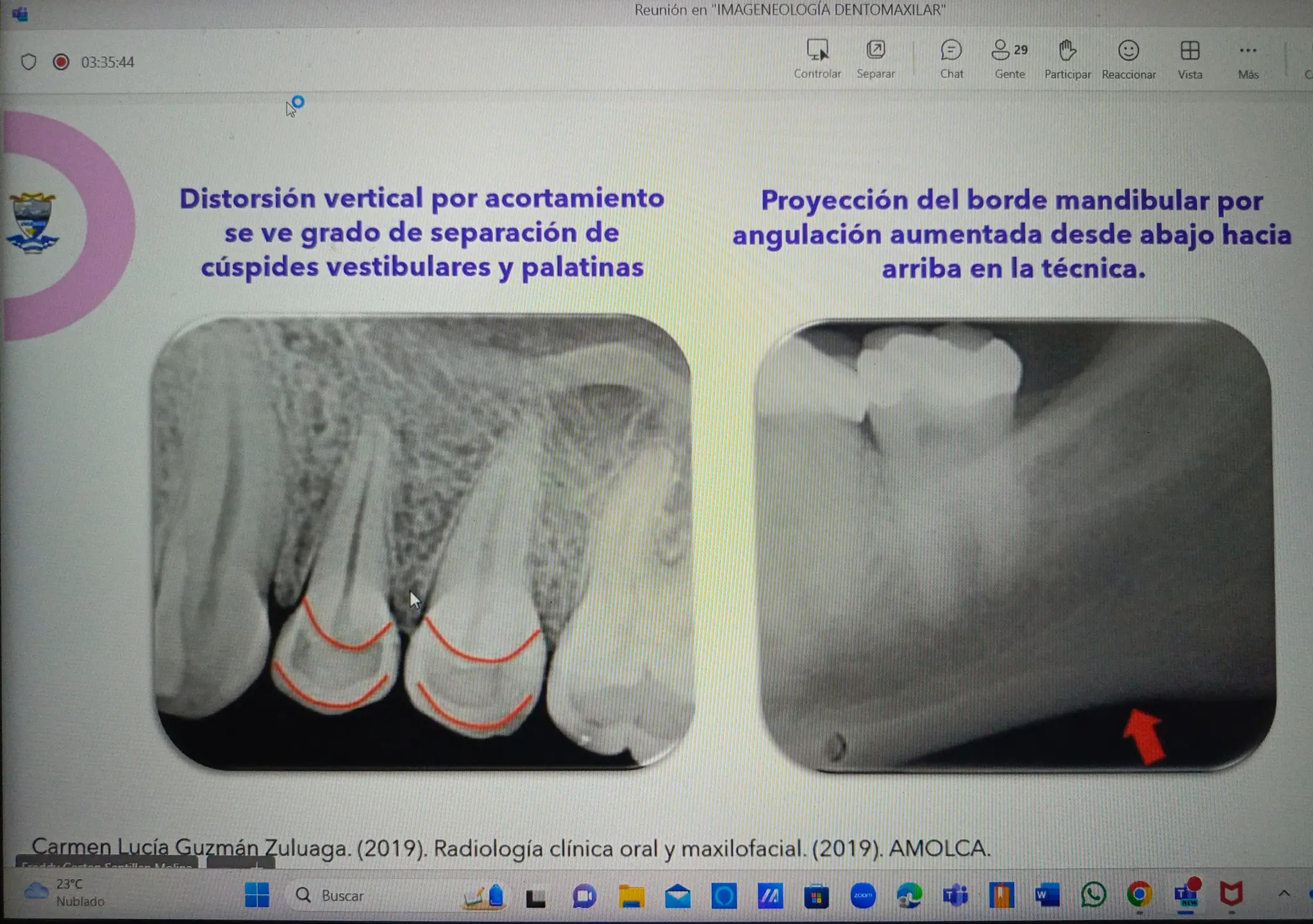 imagenologia 1 clase tecnica periapical rx | PPT