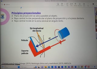 imagenologia 1 clase tecnica periapical rx | PPT