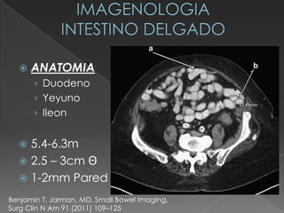 Imagenologia de intestino delgado | PPTX