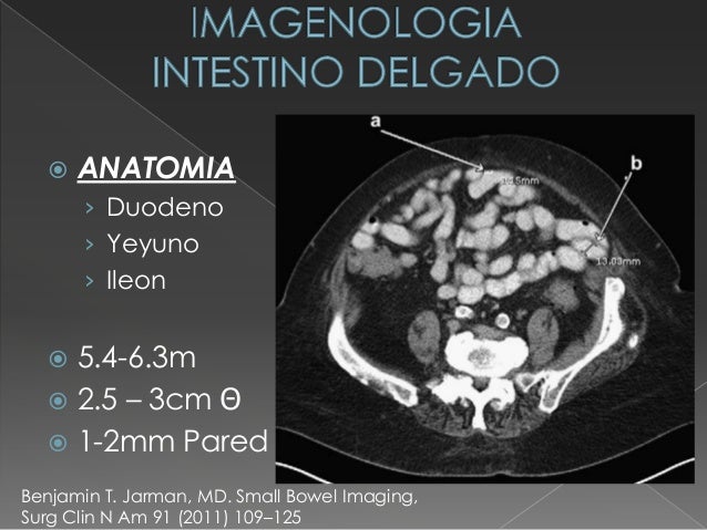 Imagenologia de intestino delgado