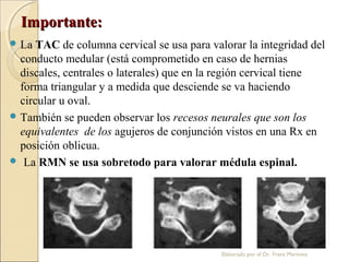 Imagenologia de la columna vertebral | PPT