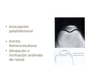 Imagenologia de rodilla_.pptx