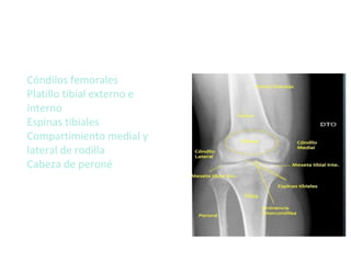 Imagenologia de rodilla_.pptx