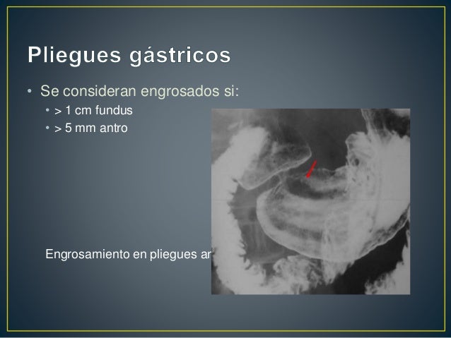 Imagenologia gastrica