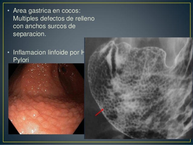 Imagenologia gastrica