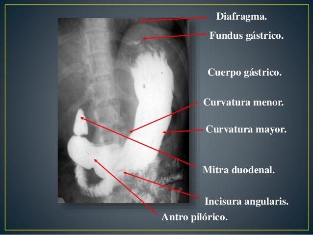 Imagenologia gastrica