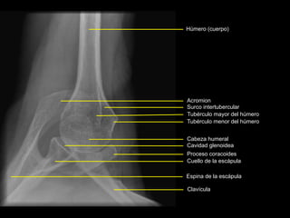 imagenologia_miembro_superior.pdf
