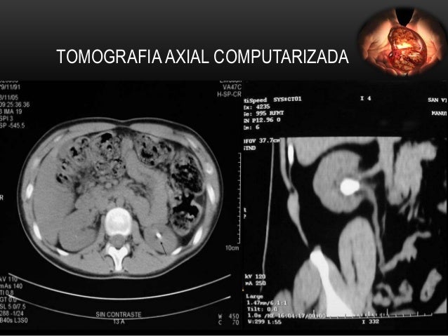 Imagenologia renal