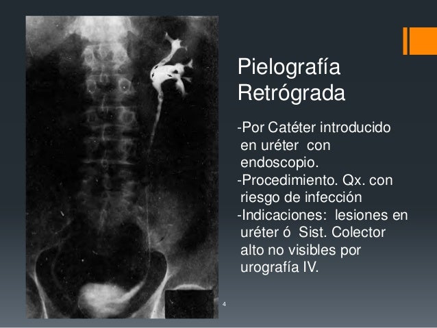 Imagenologia sistema urinario