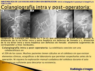 Imagenologia vias biliares | PPT