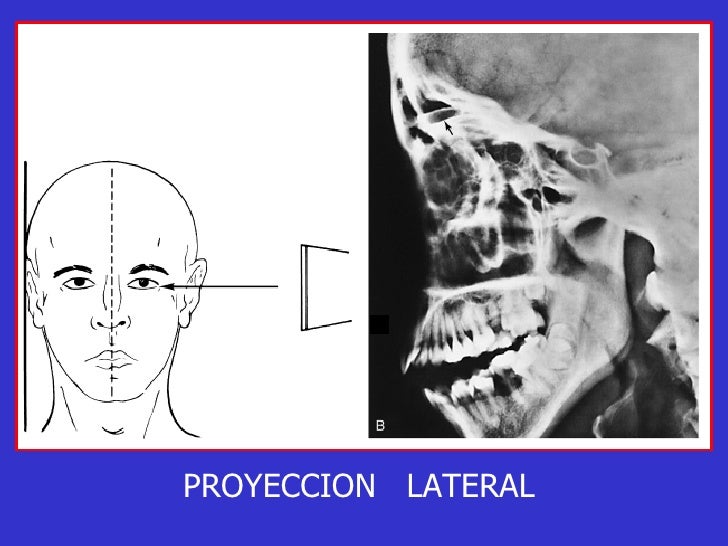Senos Paranasales Imagenología