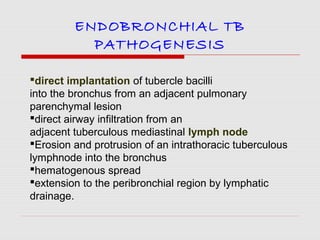 Imaging: Endobronchial TB | PPT