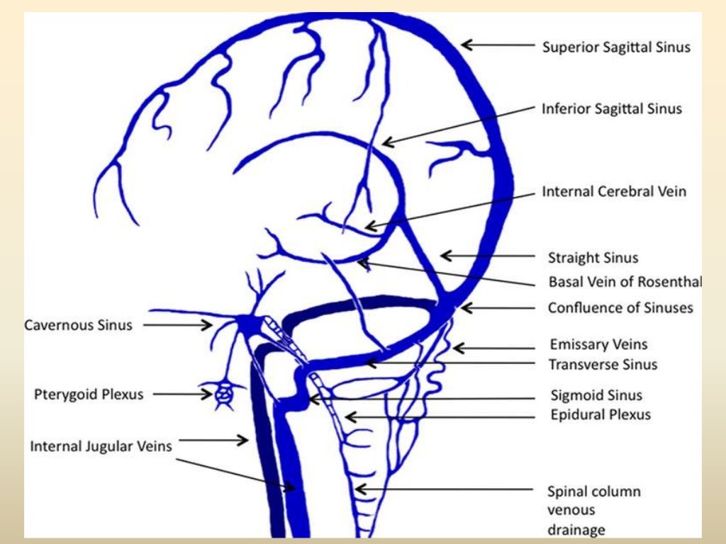 Imaging: Cortical Vein Thrombosis