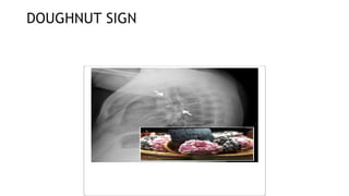 IMAGE OF THE WEEK...pptx | Lung and Respiratory Health | Diseases and ...